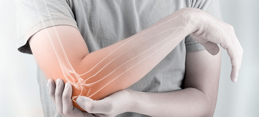 Diferencia entre epicondilitis y epitrocleitis | Traumavance