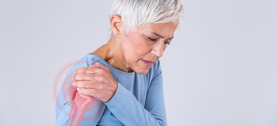 Síndrome Subacromial: Qué Es, Síntomas Y Cómo Recuperarse – ARXVJ